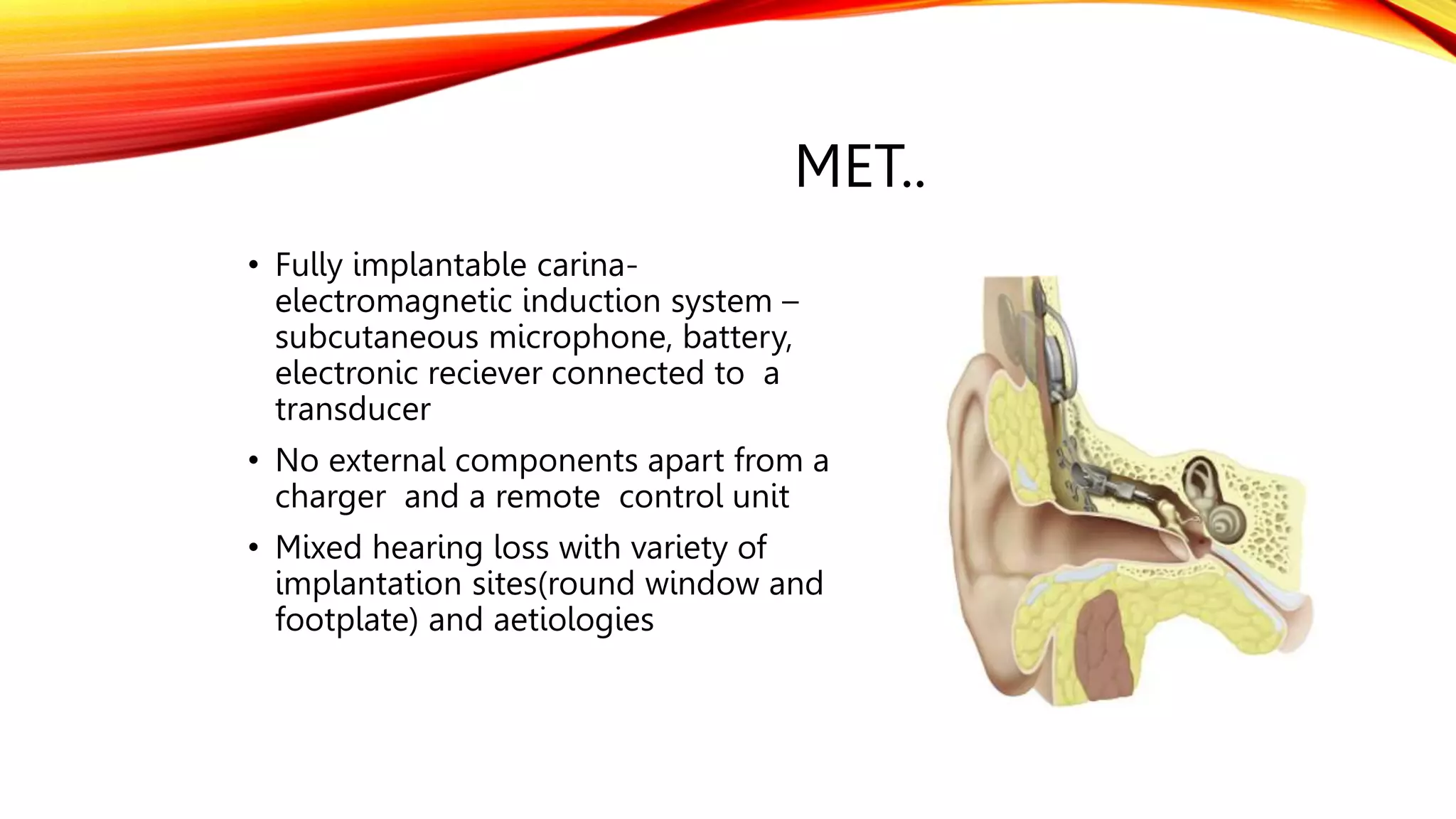 MIDDLE EAR IMPLANTS.pptx