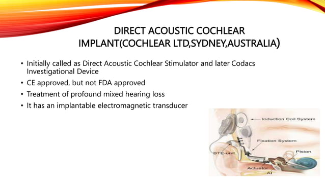 MIDDLE EAR IMPLANTS.pptx