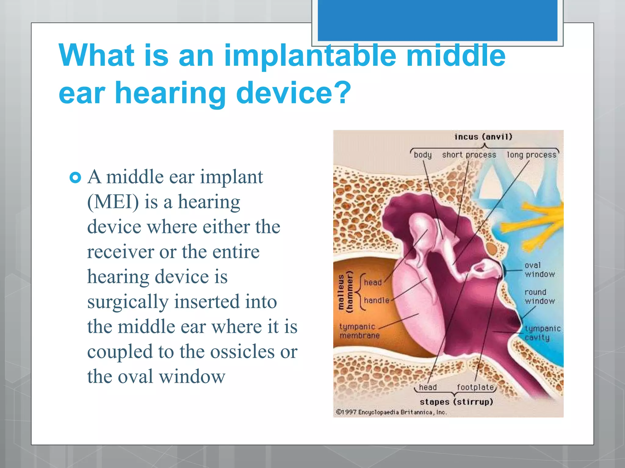 MIDDLE EAR IMPLANTS ppt new.pptx