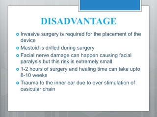 MIDDLE EAR IMPLANTS ppt new.pptx