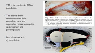 Anatomy and Overview of Middle Ear Mucosal Folds | PPTX