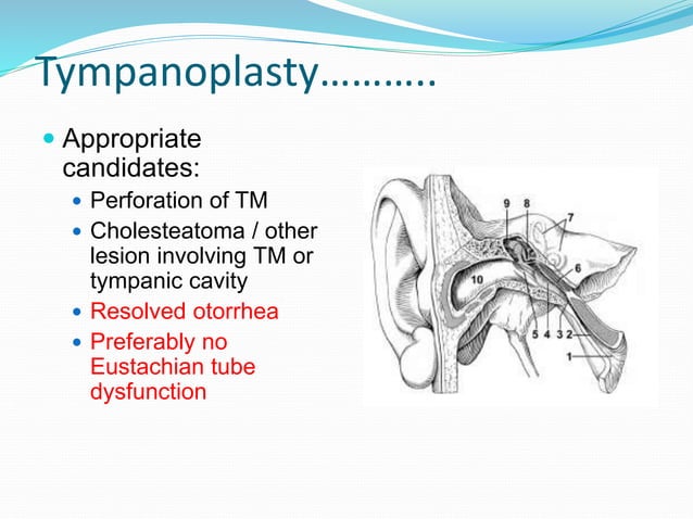 Middle ear reconstruction | PPTX