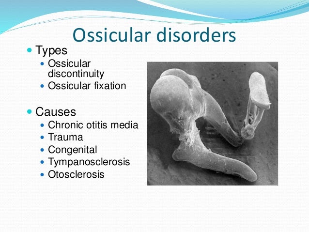 Middle ear reconstruction