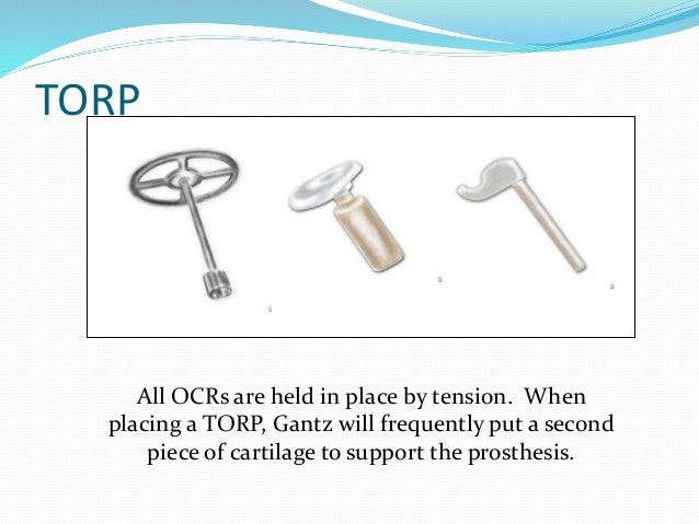 Middle ear reconstruction