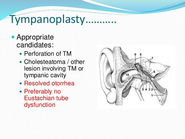 Middle ear reconstruction