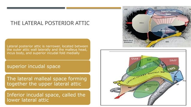 middle ear spaces and mucosal folds Otorhinolaryngology | PPTX | Ear ...