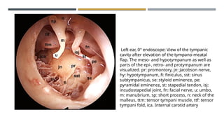 middle ear spaces and mucosal folds.pptx