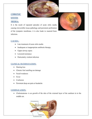 MIDDLE EAR MSN | PDF