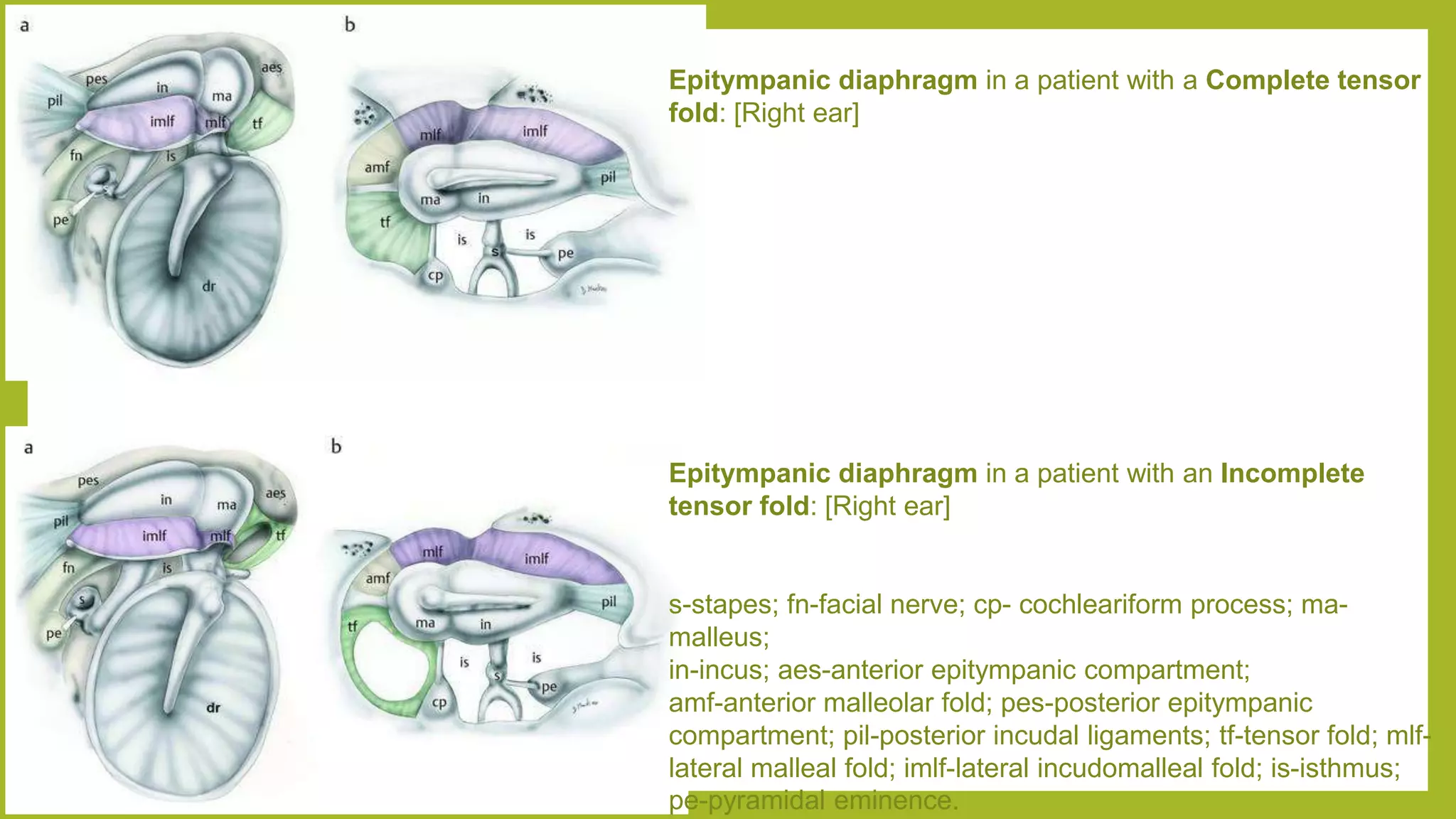 Middle ear ventilatory pathway and Mucosal folds.pptx