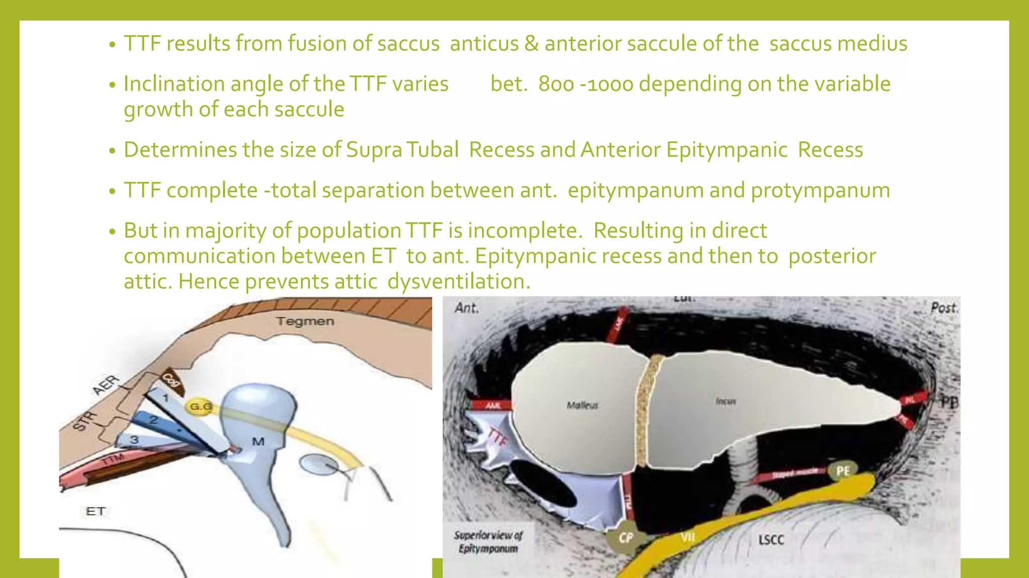 Middle ear ventilatory pathway and Mucosal folds.pptx