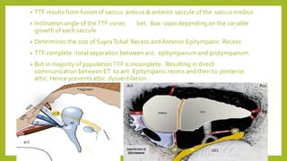 Middle ear ventilatory pathway and Mucosal folds.pptx