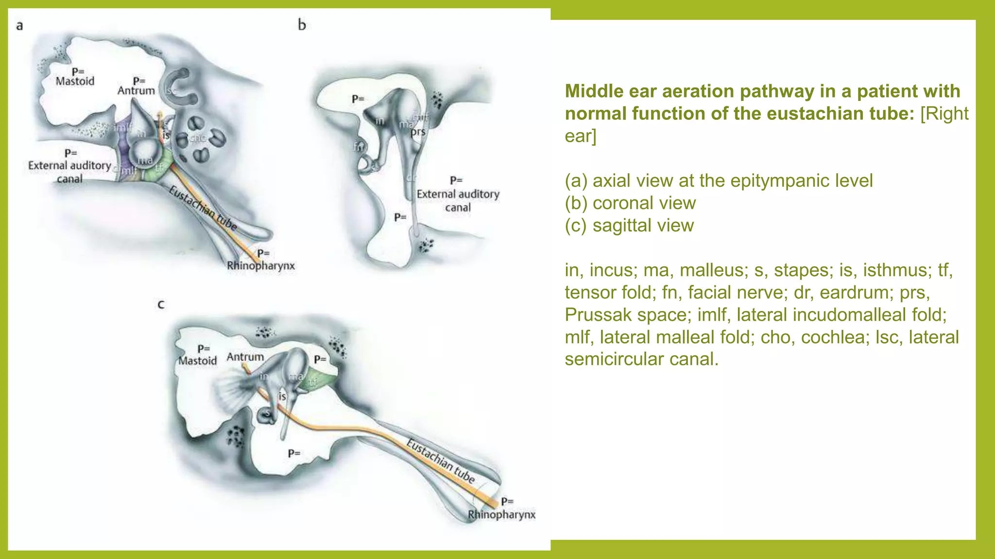 Middle ear ventilatory pathway and Mucosal folds.pptx