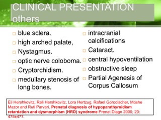 Middle east syndrome, sanjad sakati syndrome | PPTX