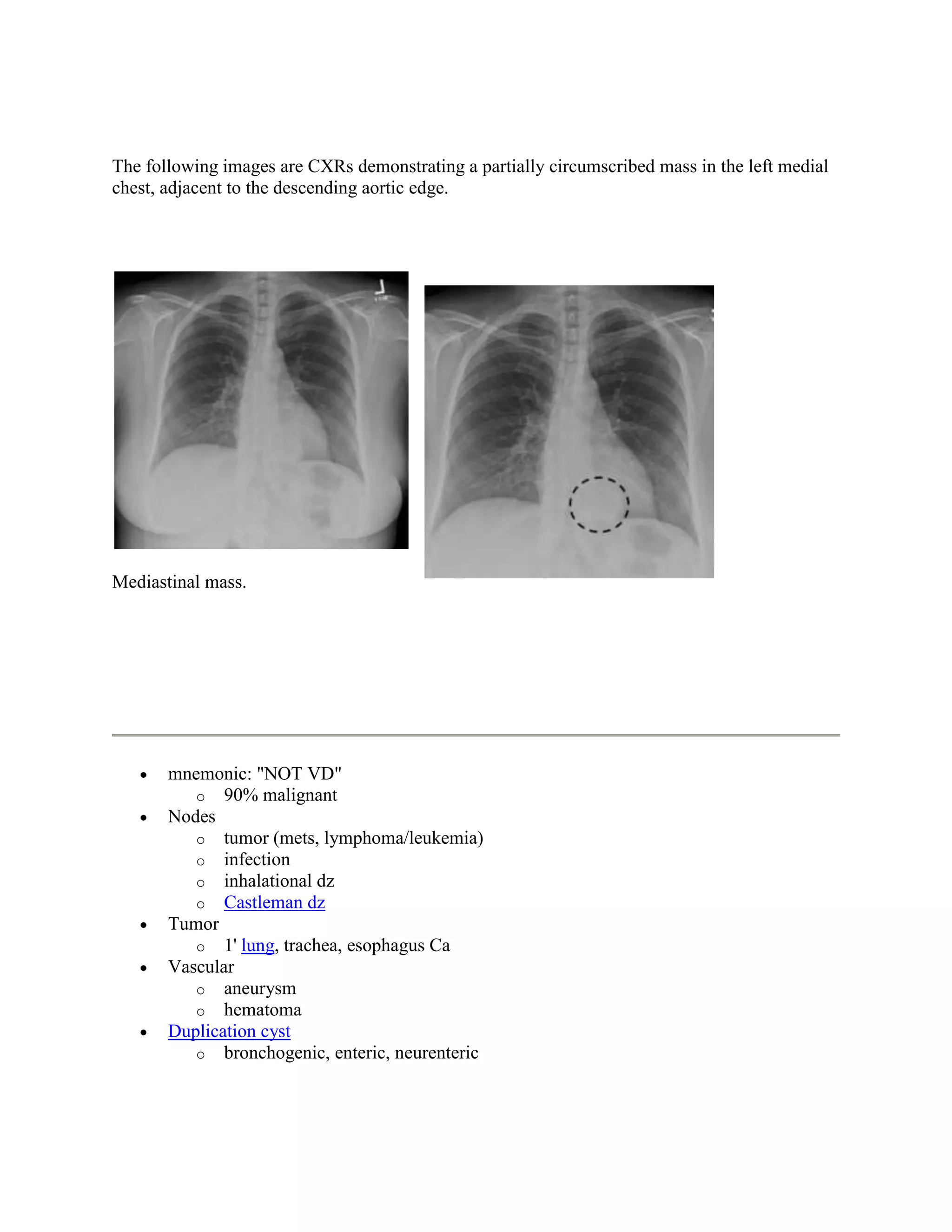 Middle mediastinal mass | DOCX