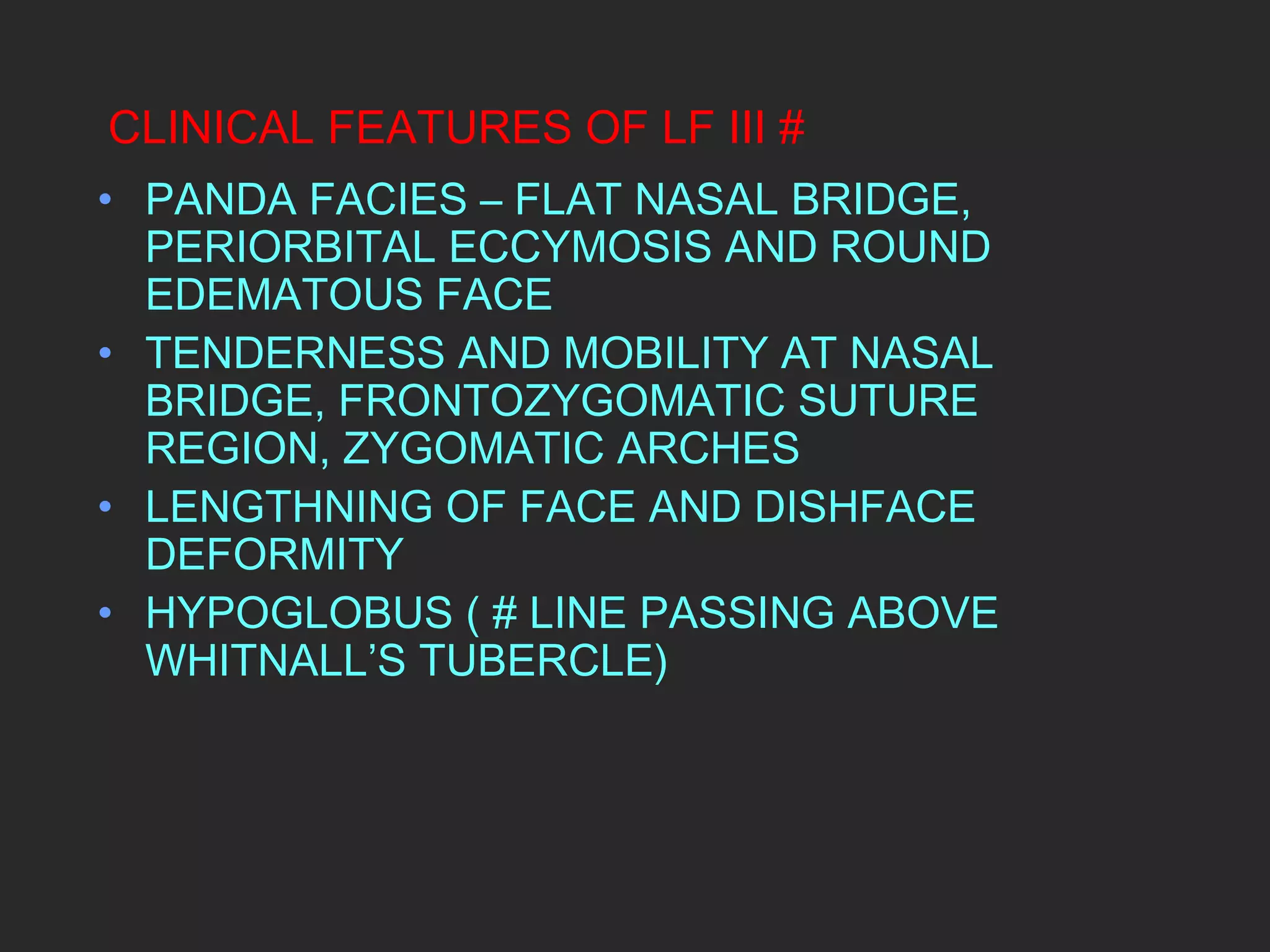 Middle third fracture & management ih | PPT