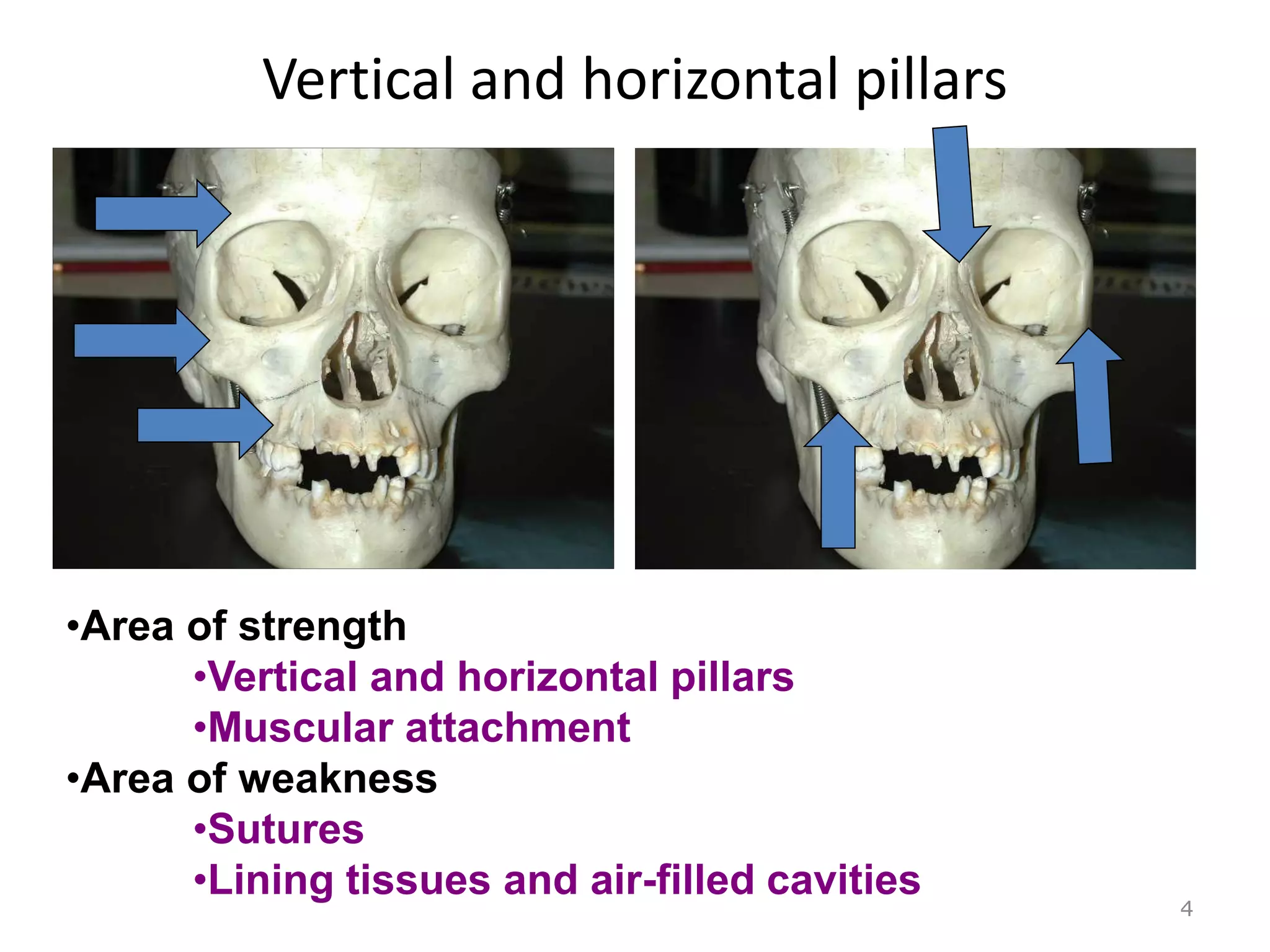 Mid face trauma | PPTX