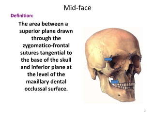 Mid face trauma | PPTX | Death, Injury, or Military Conflict ...