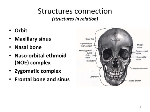 Mid face trauma | PPTX | Death, Injury, or Military Conflict ...
