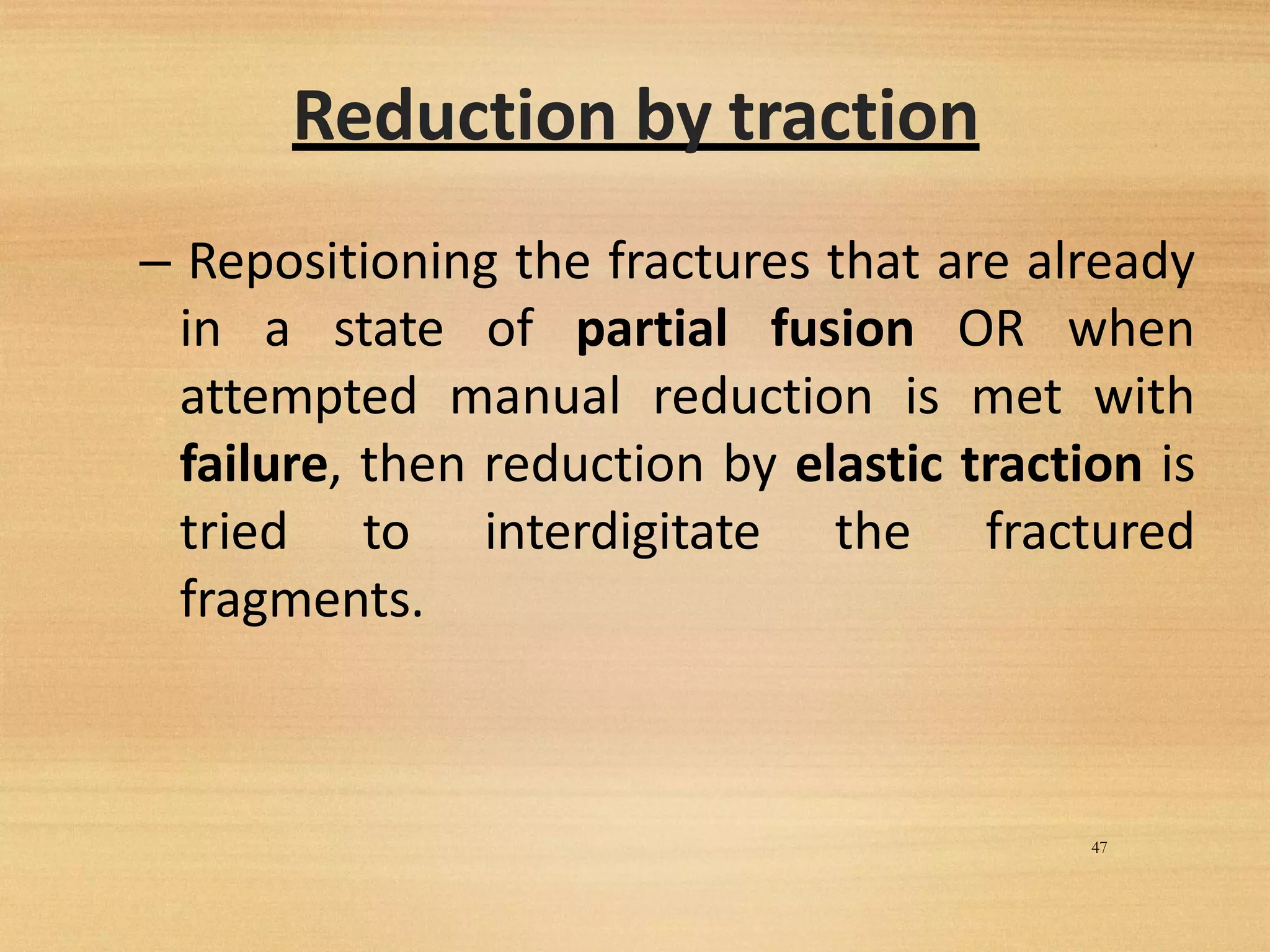 Le Fort Fractures | PDF