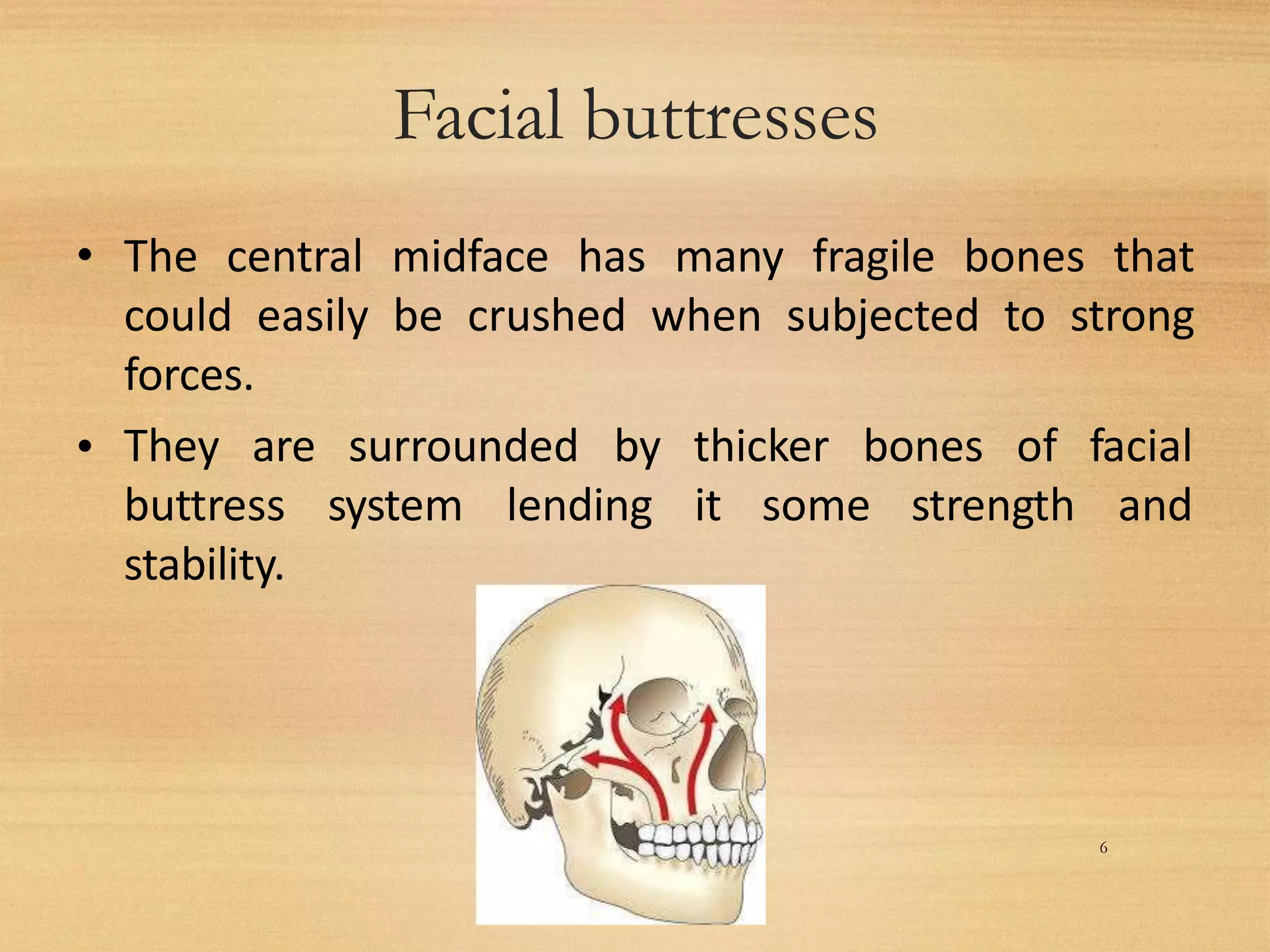 Le Fort Fractures | PDF