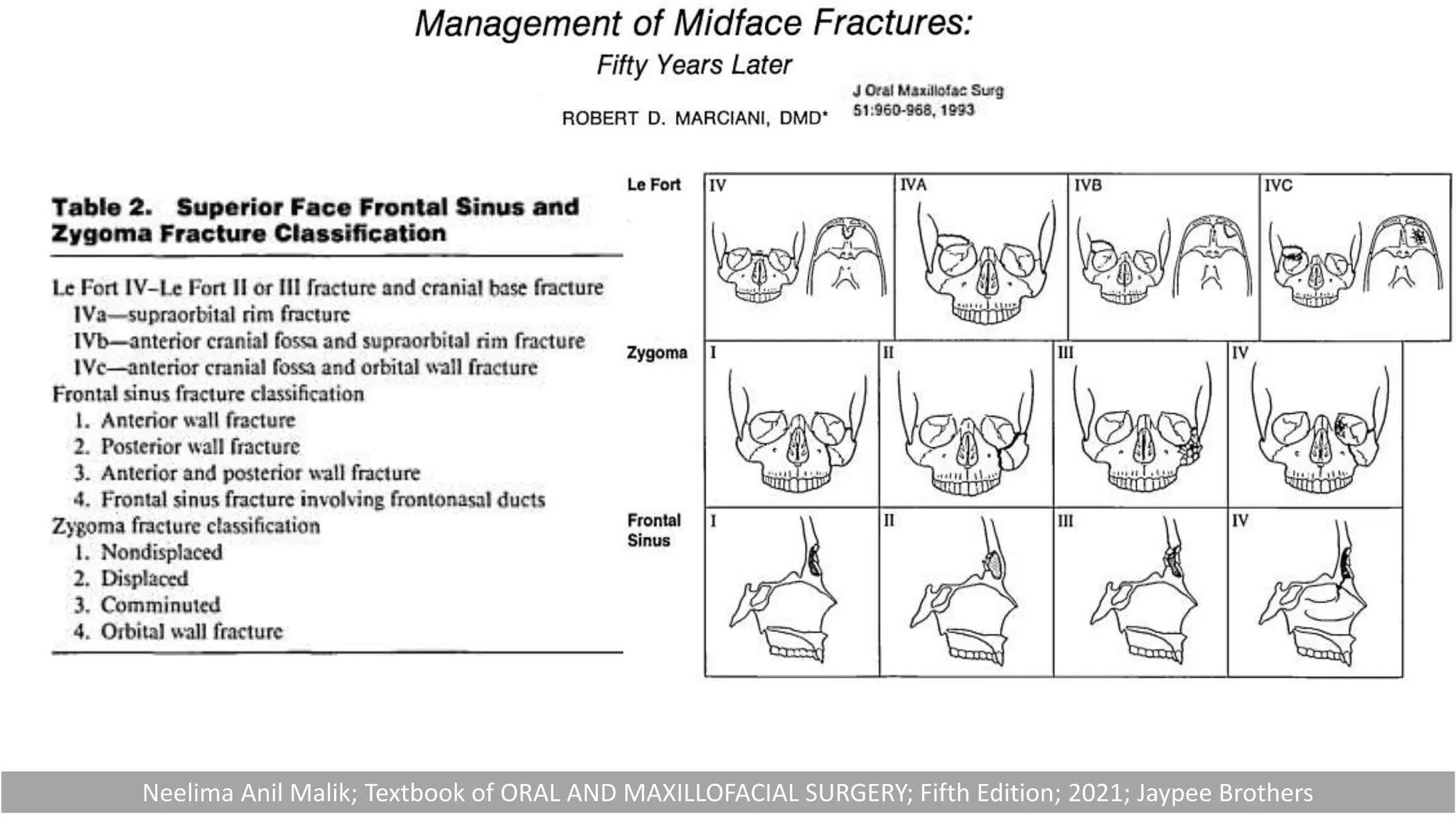Midface fracture.pptx