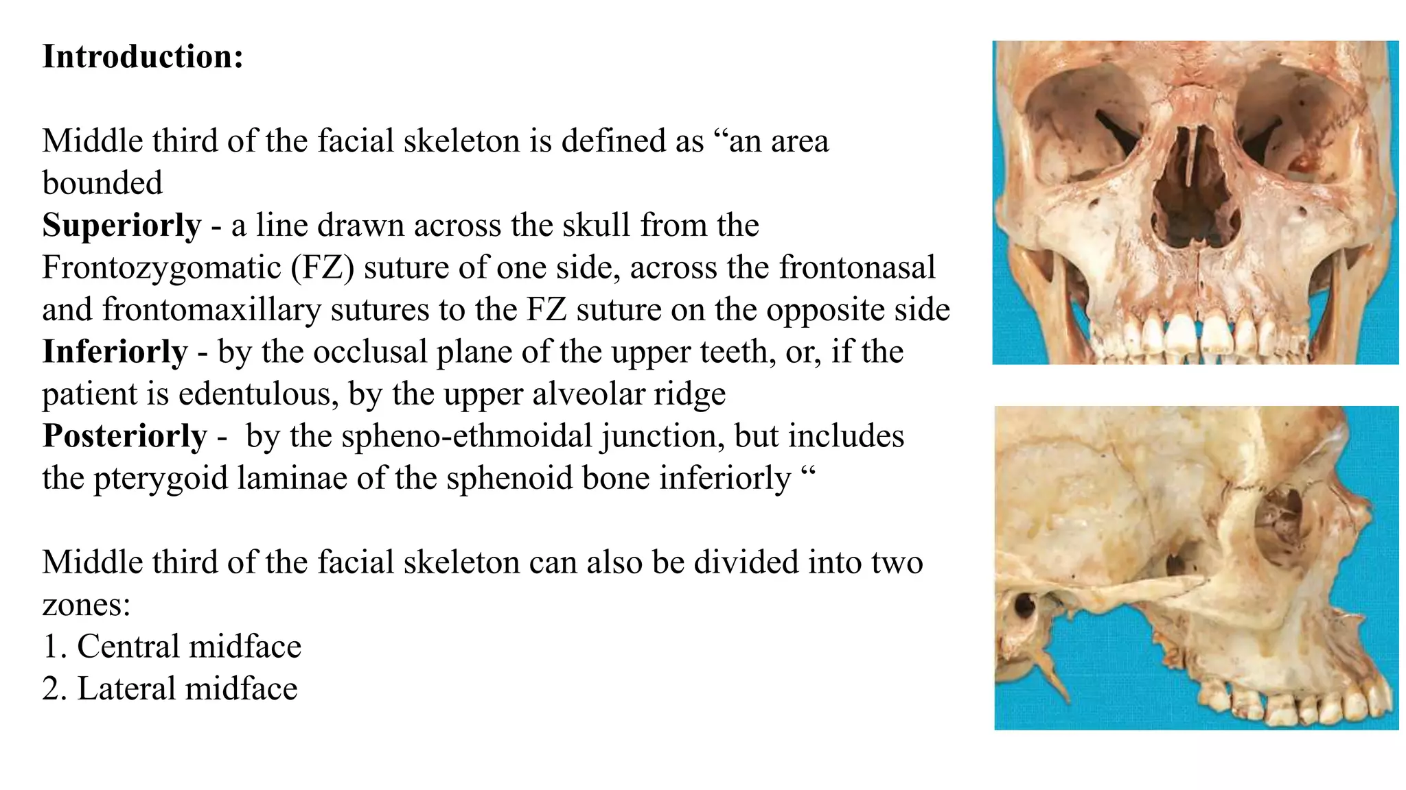 Midface fracture.pptx