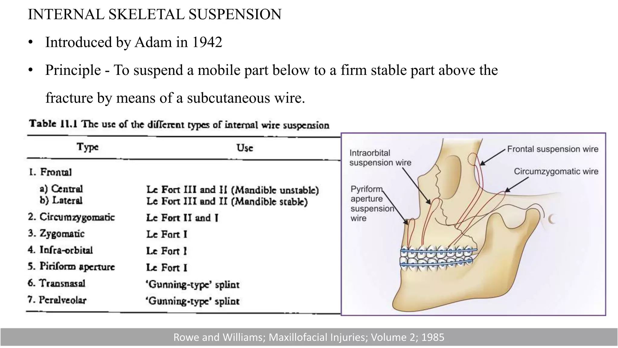 Midface fracture.pptx