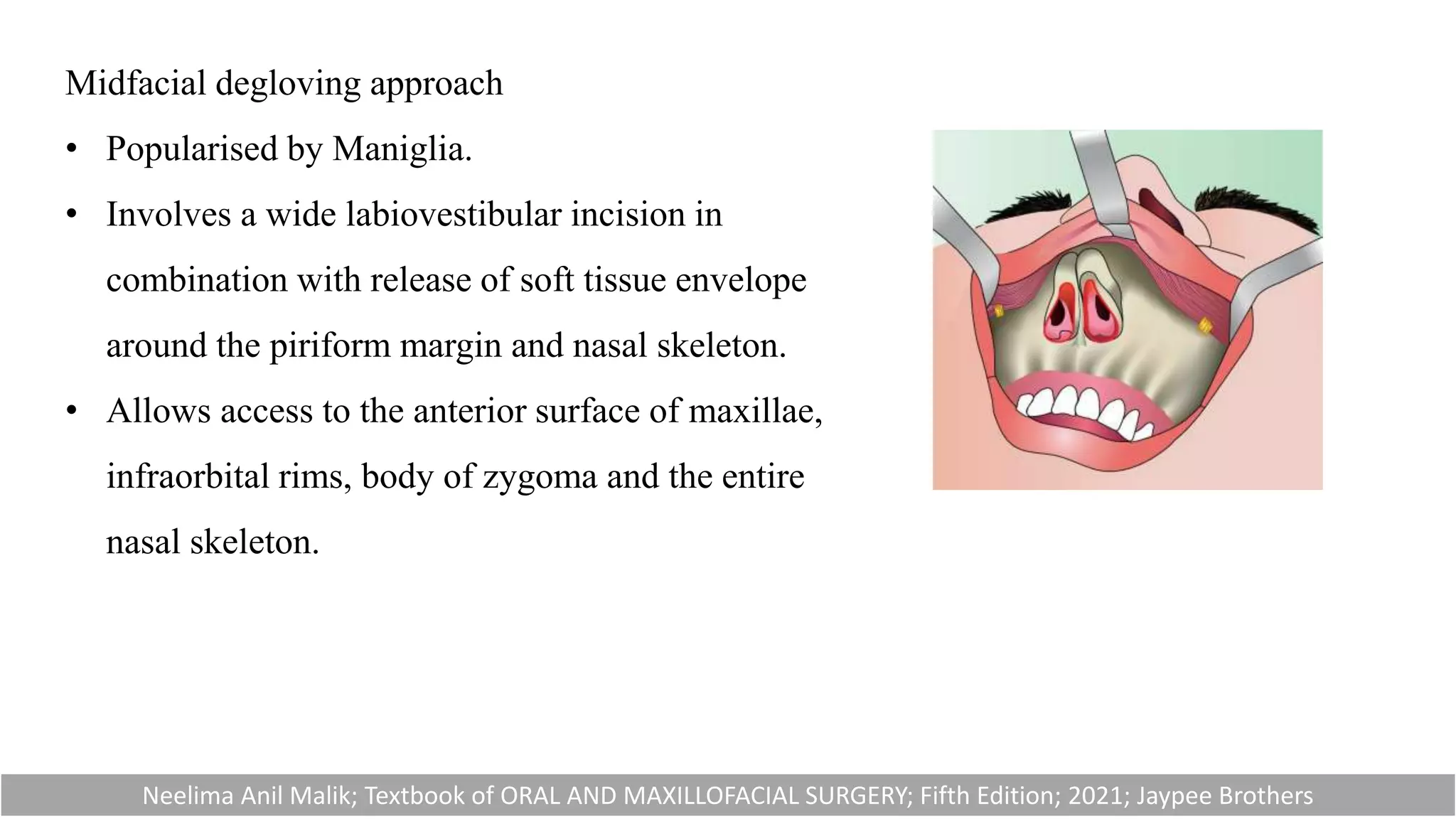 Midface fracture.pptx | Death, Injury, or Military Conflict | Sensitive ...