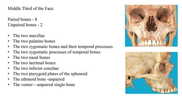 Midface fracture.pptx | Death, Injury, or Military Conflict | Sensitive ...