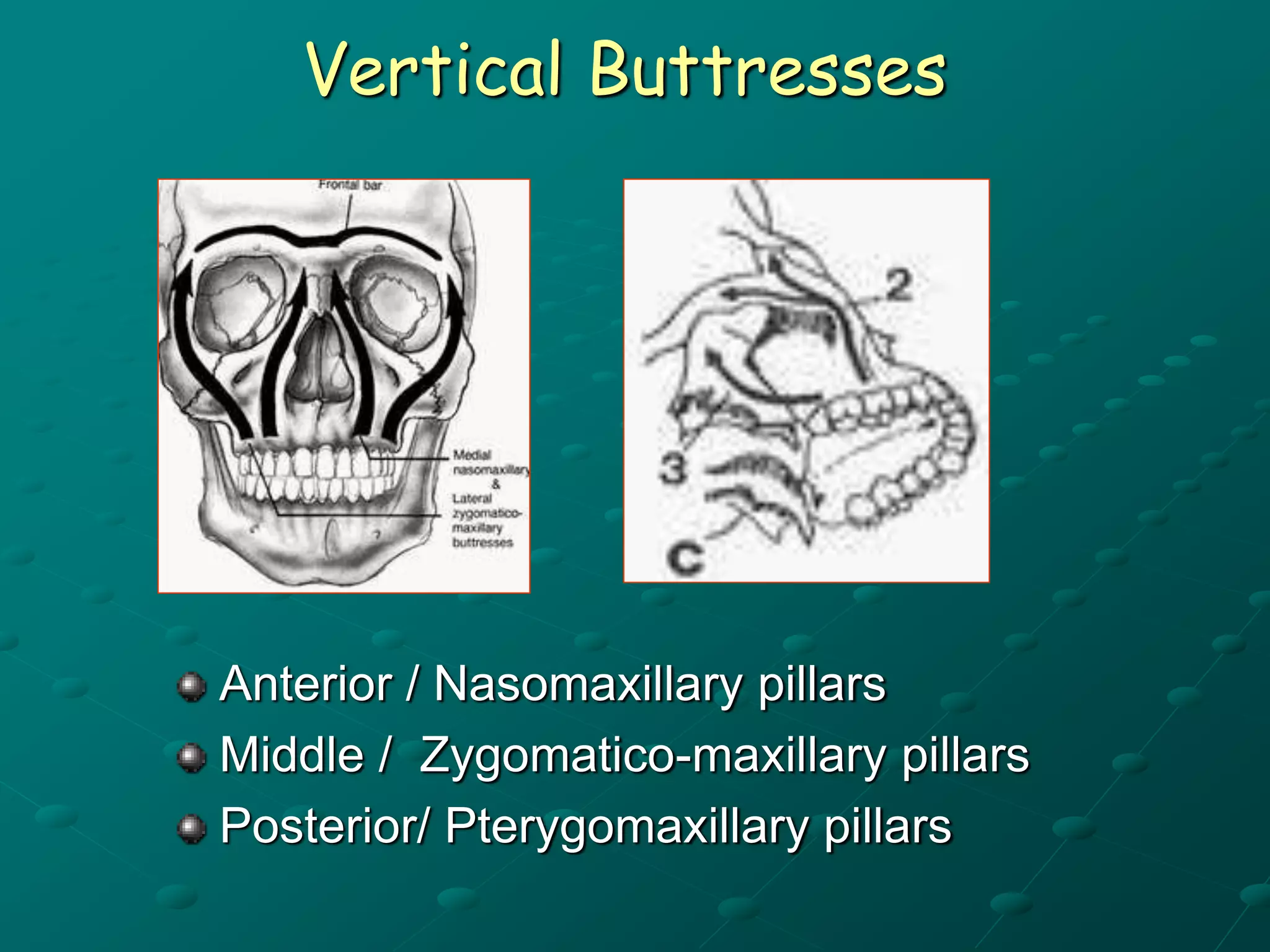 Midface Fracture Part-1.ppt