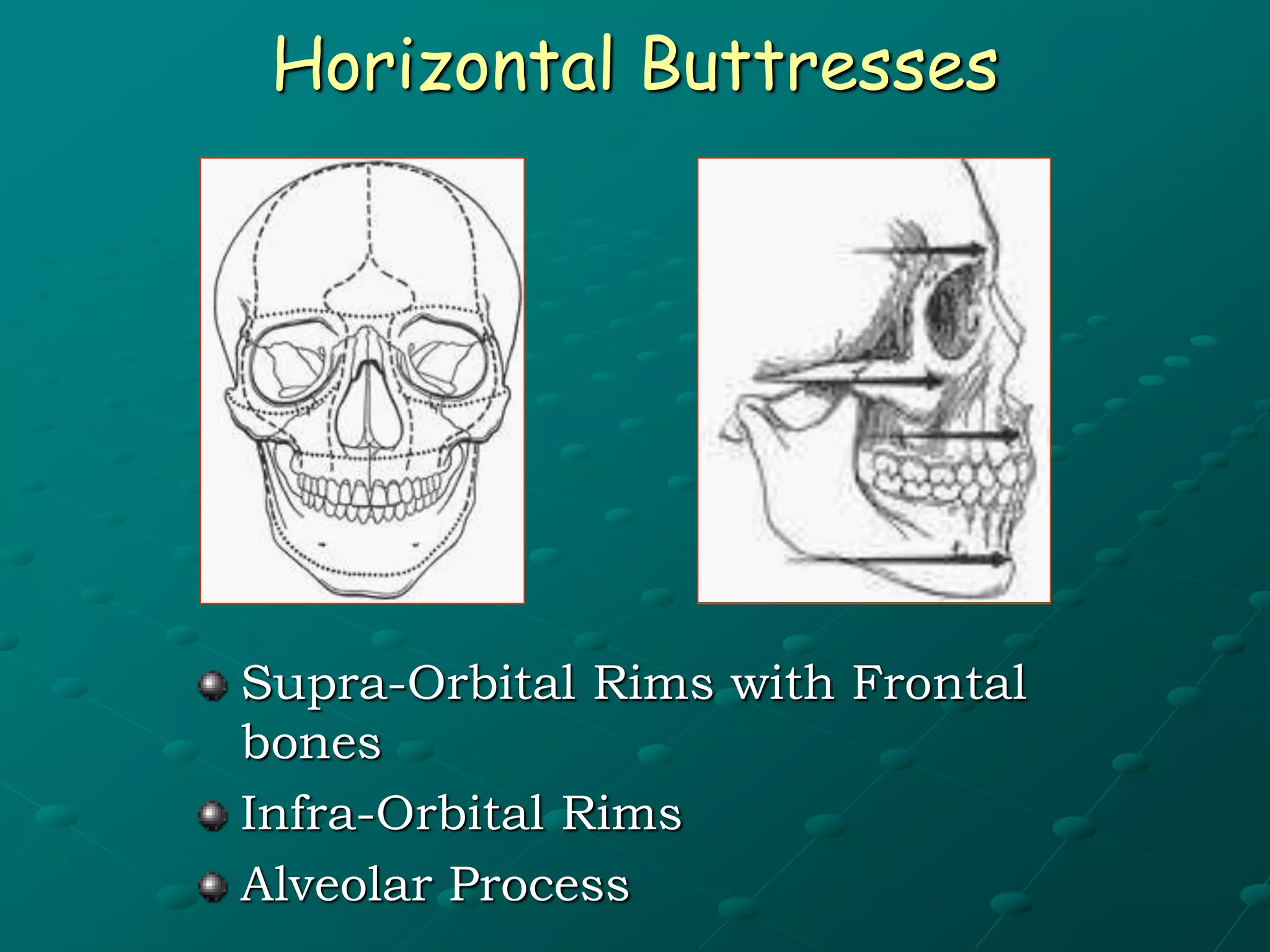 Midface Fracture Part-1.ppt