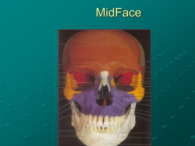 Midface Fracture Part-1.ppt