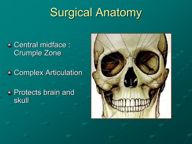 Midface Fracture Part-1.ppt