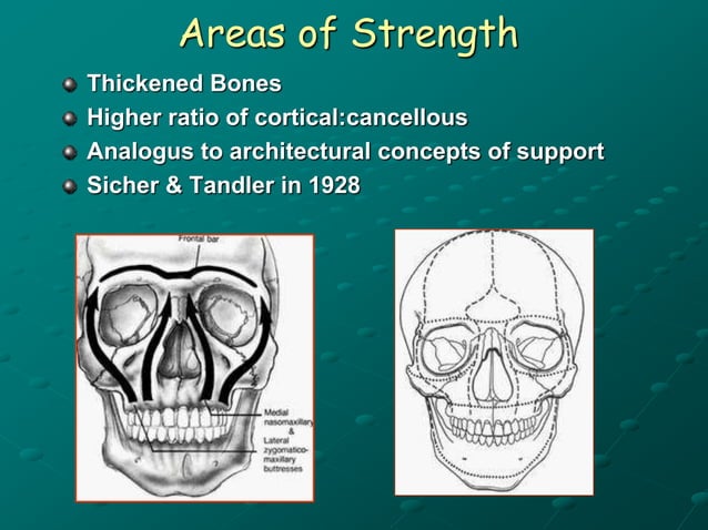 Midface Fracture Part-1.ppt