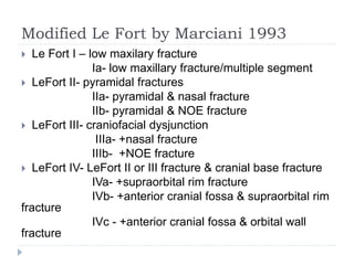 Mid facial fractures | PPTX