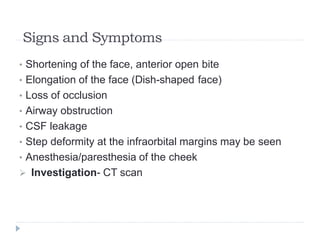Mid facial fractures | PPTX