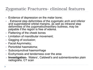 Mid facial fractures | PPTX