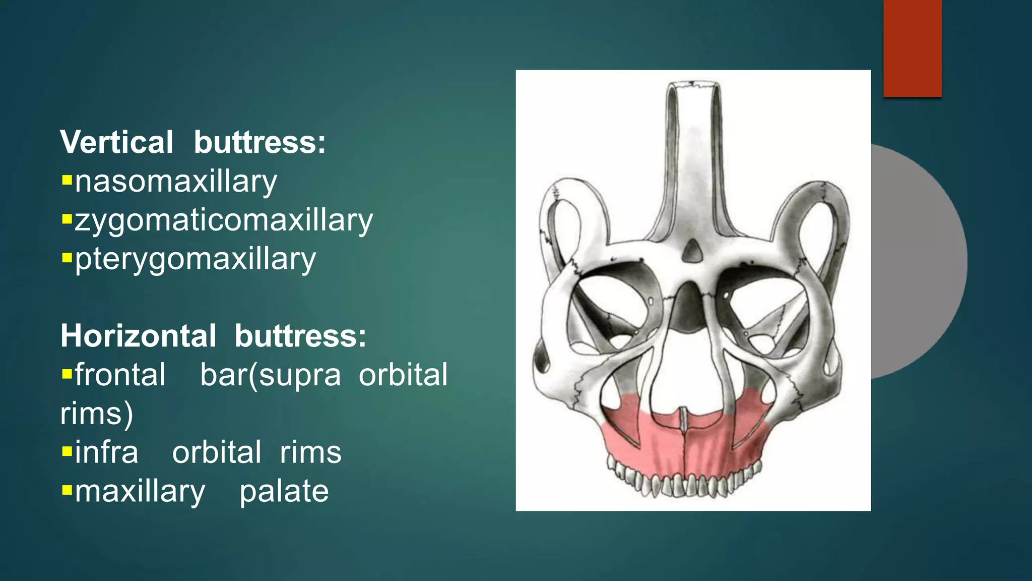 Midface fractures | PPTX