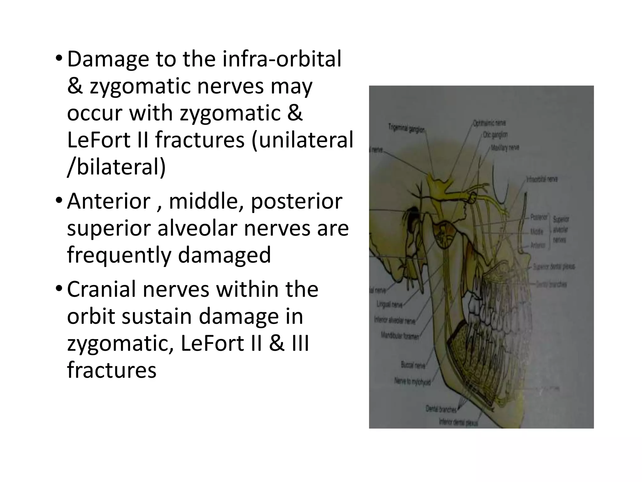 MID FACE FRACTURES.pptx