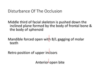 MID FACE FRACTURES.pptx