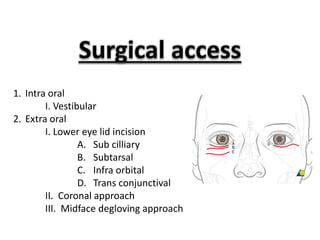 MID FACE FRACTURES.pptx