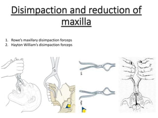 MID FACE FRACTURES.pptx