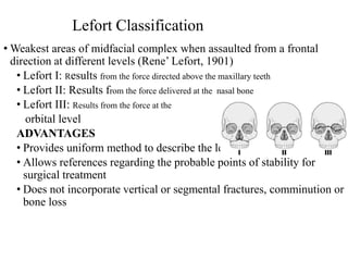 MID FACE FRACTURES.pptx