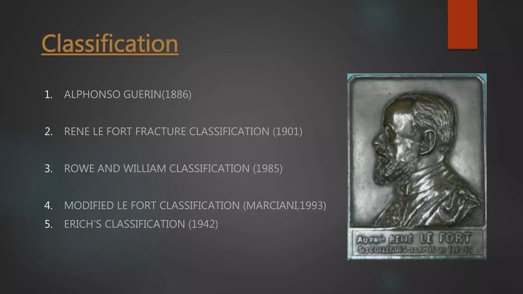 Midface fractures | PPTX