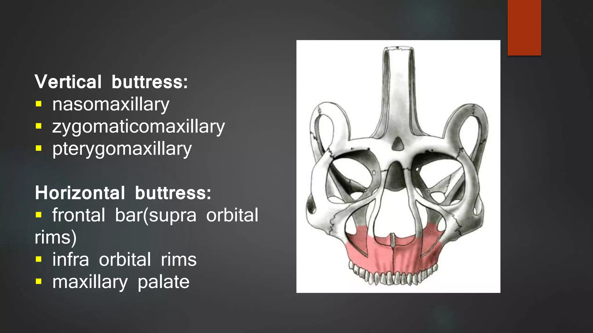 Midface fractures | PPTX