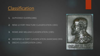 Midface fractures | PPTX