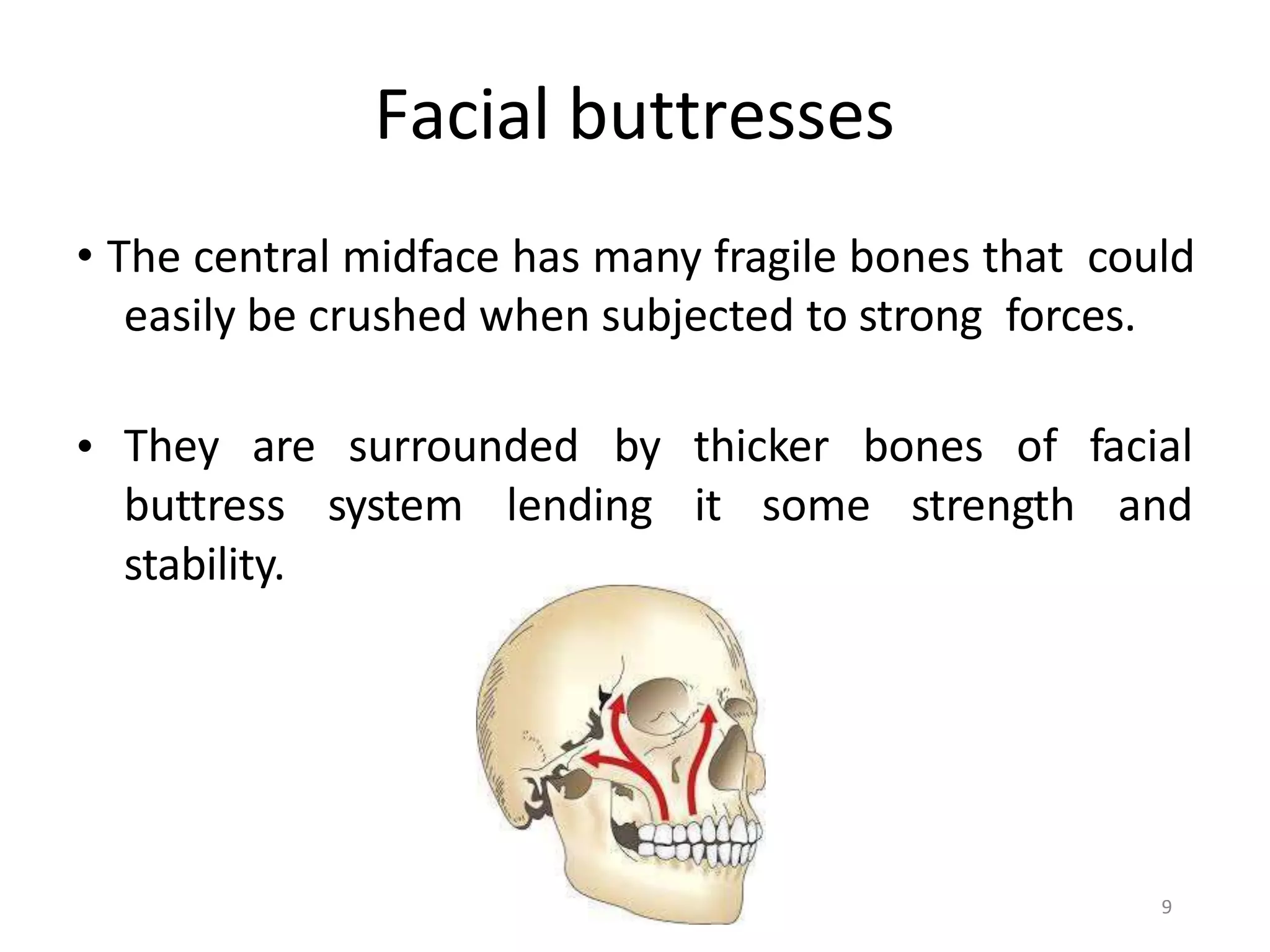 Midfacial fractures | PPTX