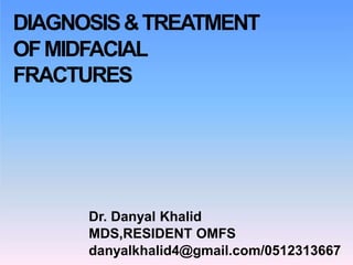 Midfacial fractures | PPTX