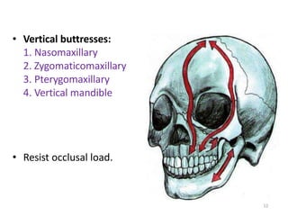 Midfacial fractures | PPTX