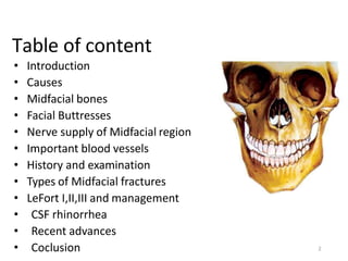 Midfacial fractures | PPTX